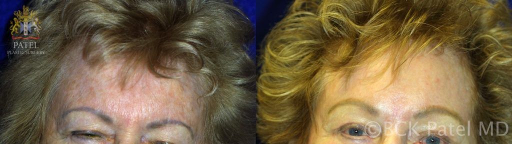 Minimally invasive surgery results presented in a gallery