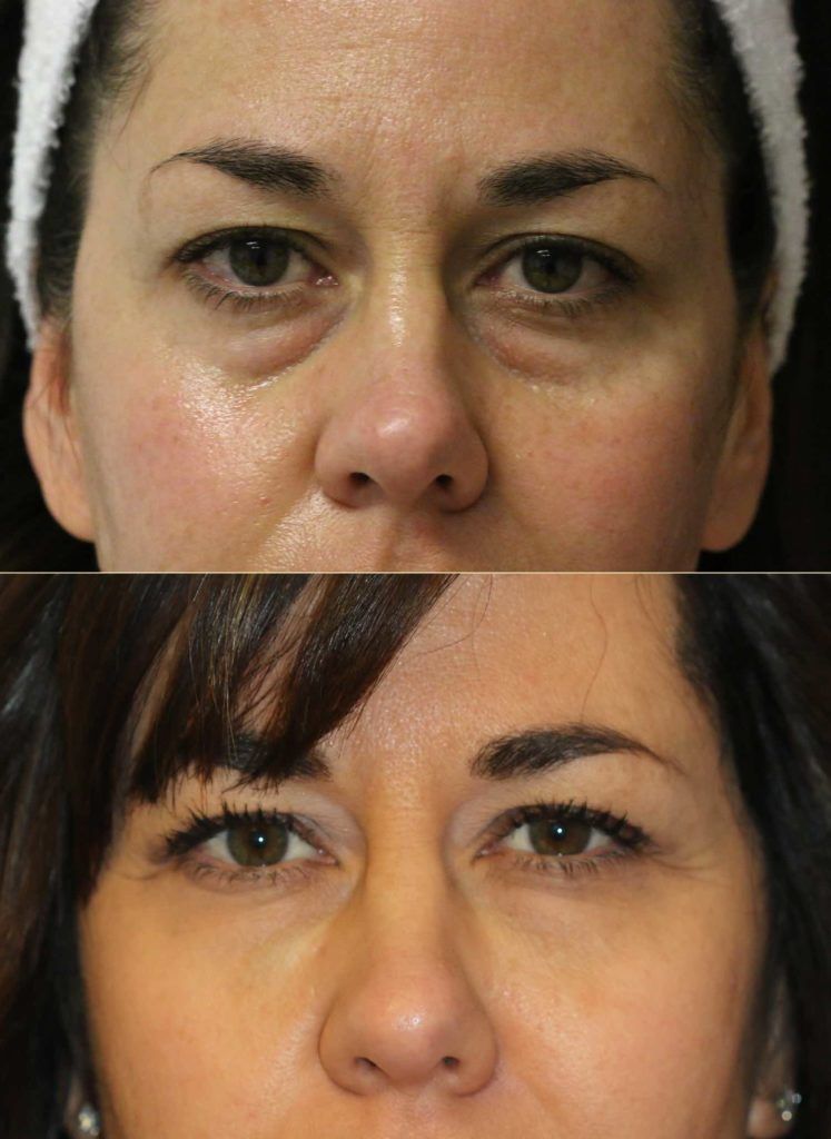 Minimally invasive surgery results presented in a gallery