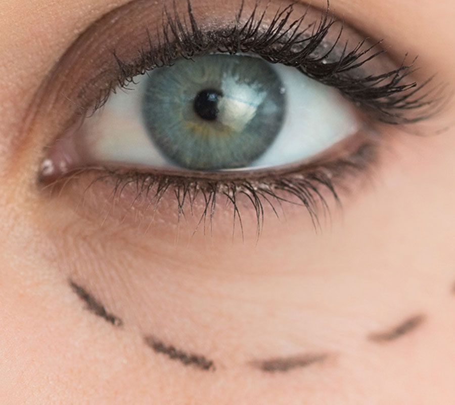 SURGICAL - Dr Bhupendra CK Patel